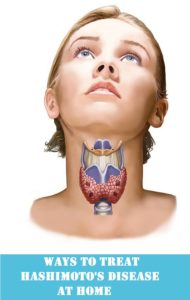 10 Home Remedies for Hashimoto’s Disease & Some Tips to Keep in Mind